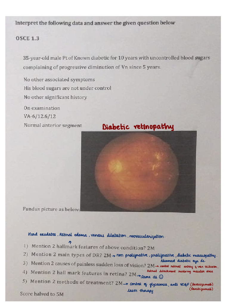 OPHTHA PRACTICAL | PDF