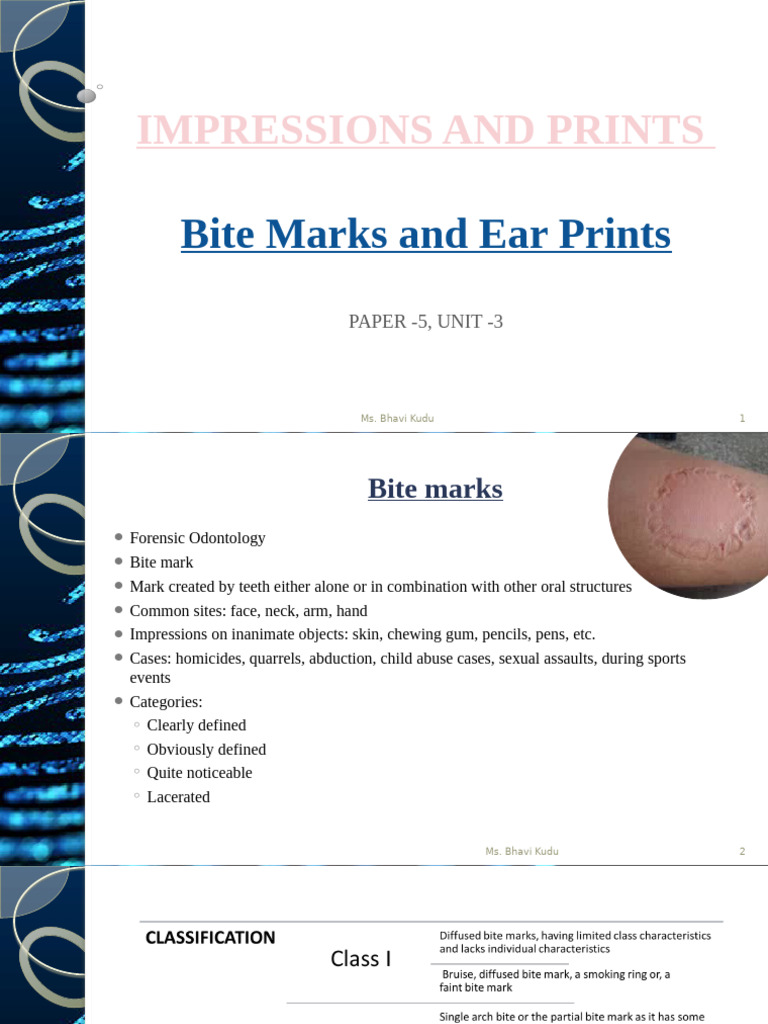Bite Marks and Ear Prints Detailed Explanation | PDF | Tooth | Forensic ...