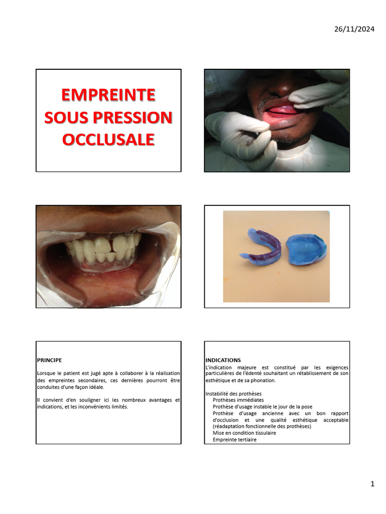 Empreintes sous pression occlusale : Guide technique | PDF