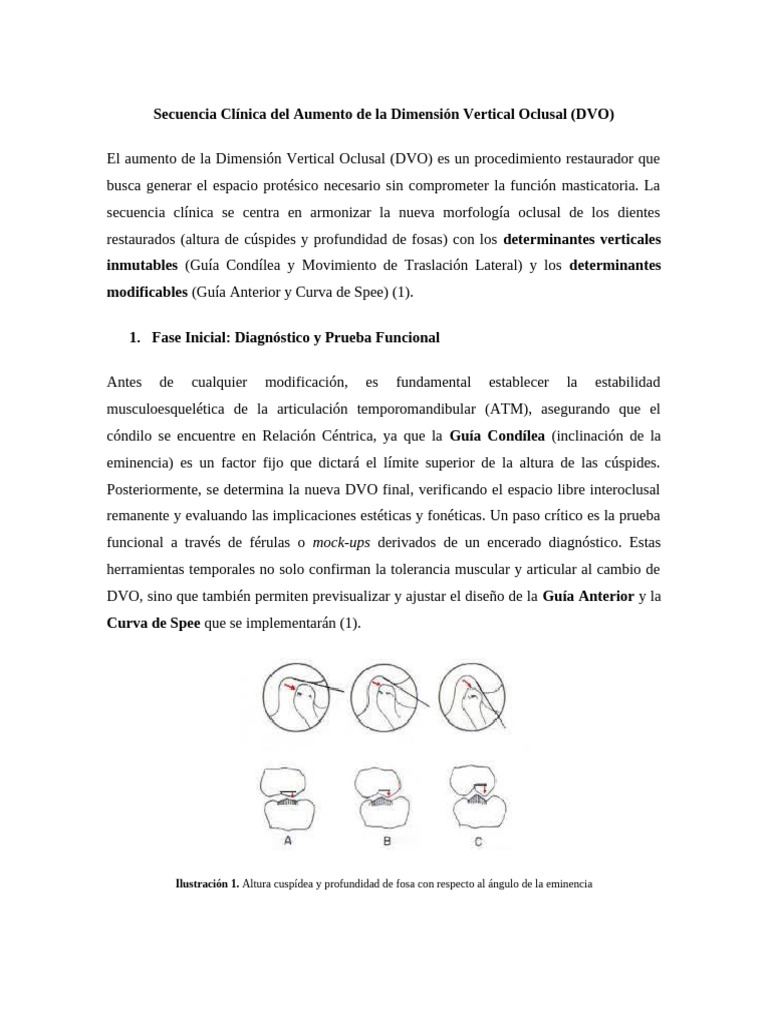 Aumento de Dimensión Vertical Oclusal DVO | PDF