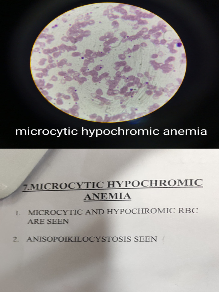 Patho Final Exam Slides (Hemat & Histopath) | PDF