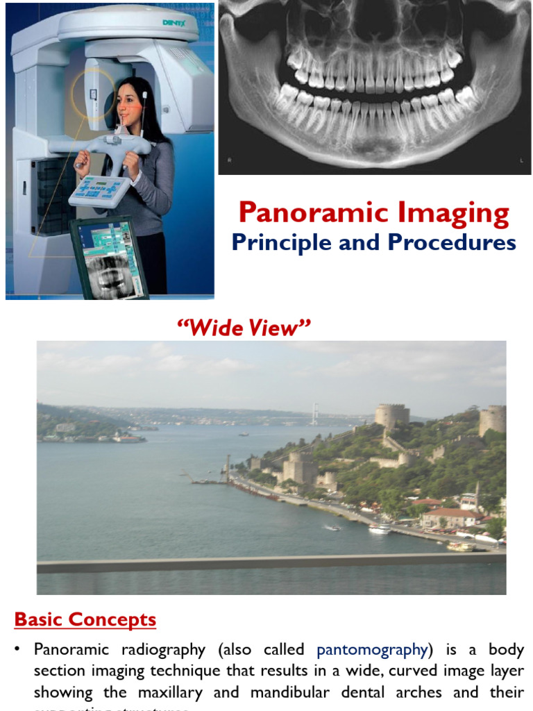 Panoramic Imaging Techniques Explained | PDF