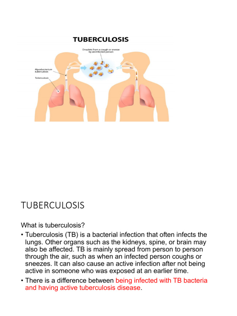 Understanding Tuberculosis: Causes and Risks | PDF | Tuberculosis ...