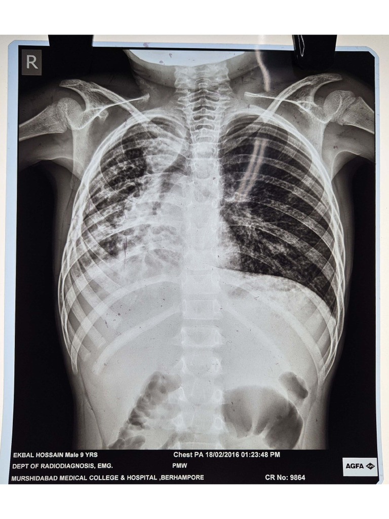 X-Rays, Charts, Instruments (Paed) | PDF