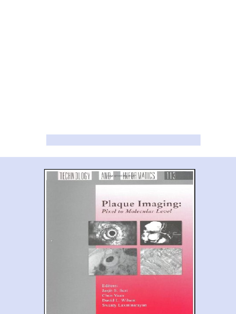 3798588 | PDF | Atheroma | Atherosclerosis