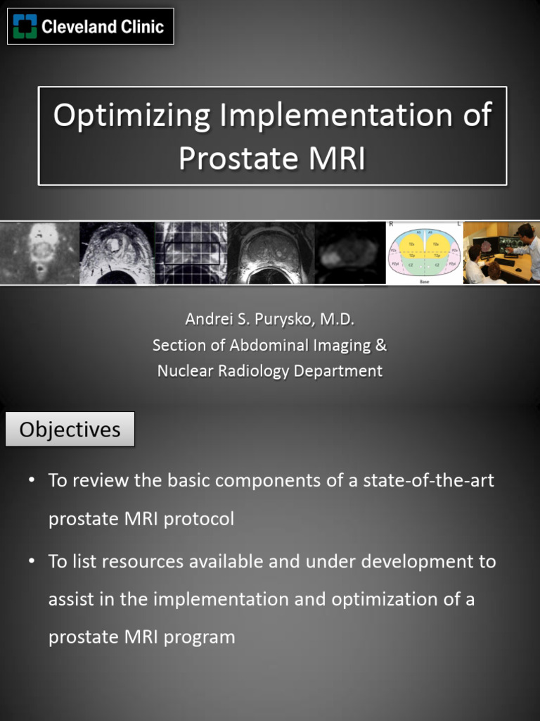 Optimizing Implementation of Prostate MRI | PDF | Magnetic Resonance ...