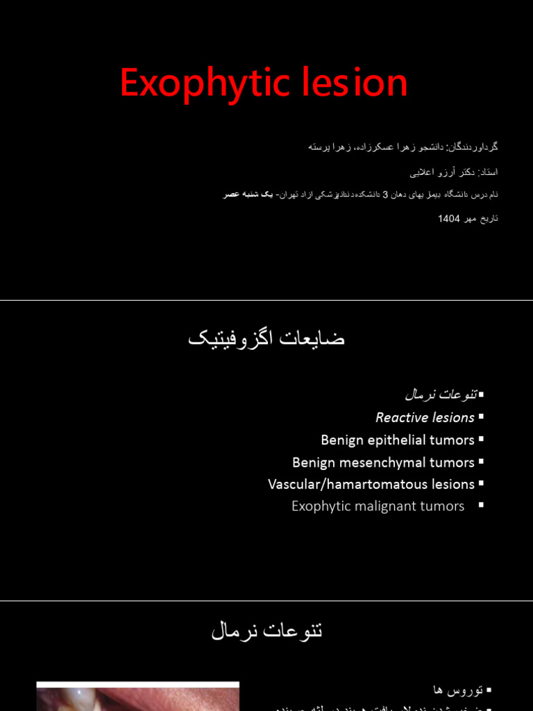 exophytic lesions نهایی | PDF