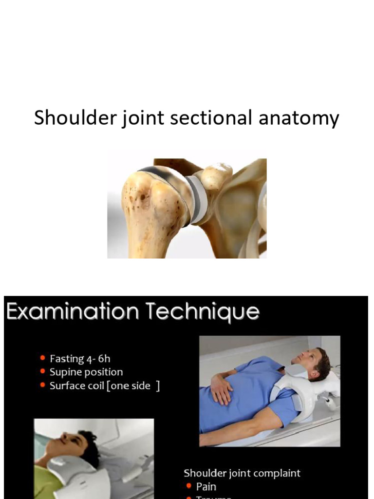 Shoulder Joint Sectional Anatomy | PDF