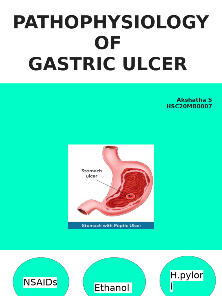 Gastric Ulcer Pathophysiology Explained | PDF