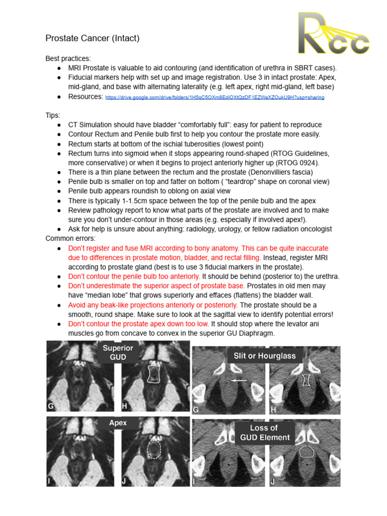 Summary Sheet 5 For Prostate (Intact) Cancer | PDF