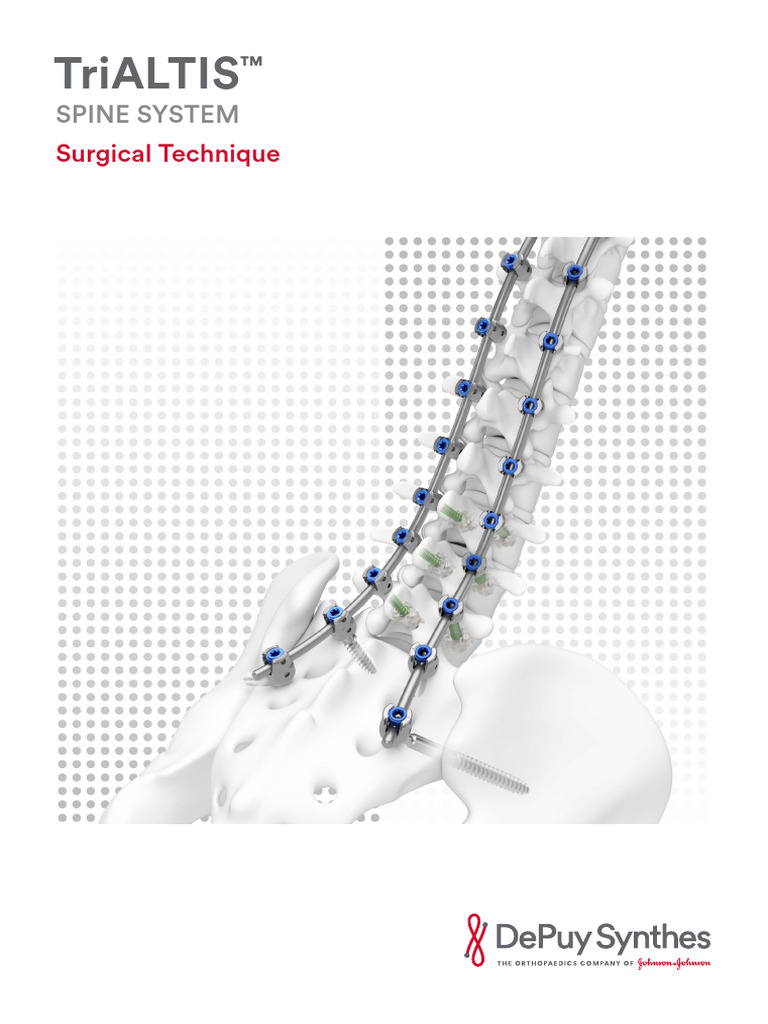 TriALTIS™ Spine System Surgical Guide | PDF | Screw | Anatomical Terms ...
