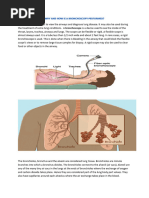 Bronchoscopy Procedure Note Sample | PDF | Pulmonology | Respiratory System