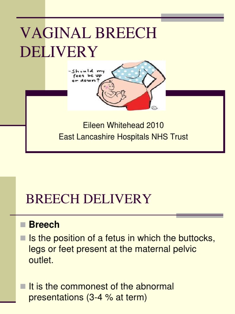 Breech Delivery | Caesarean Section | Childbirth
