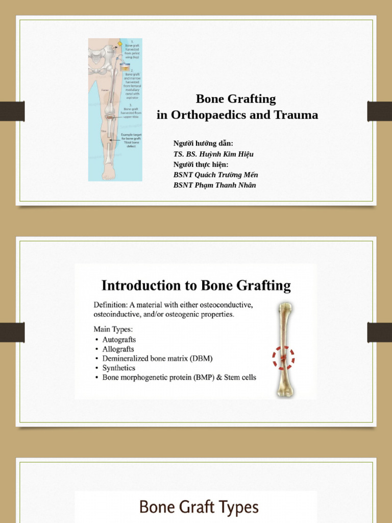 Bone Grafting in Orthopaedics and Trauma | PDF