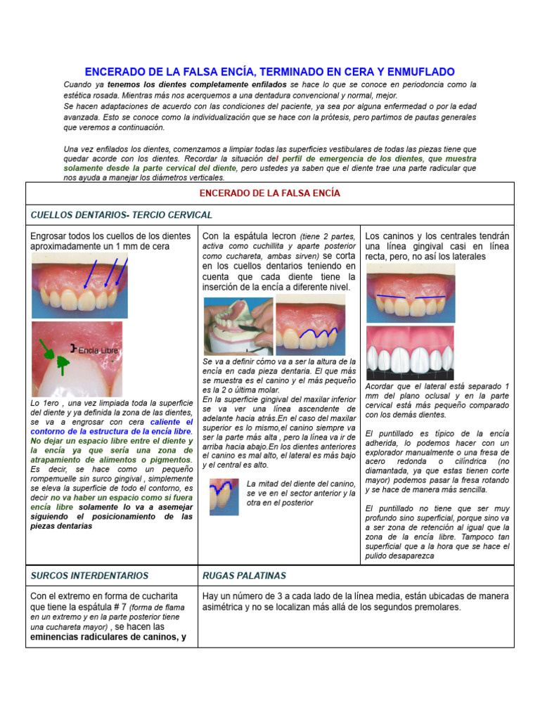 RH S13-Encerado de La Falsa Encía, Terminado en Cera y Enmuflado | PDF ...