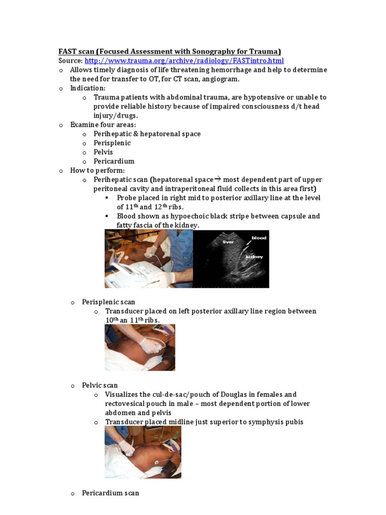 Trauma - Fast Scan | PDF