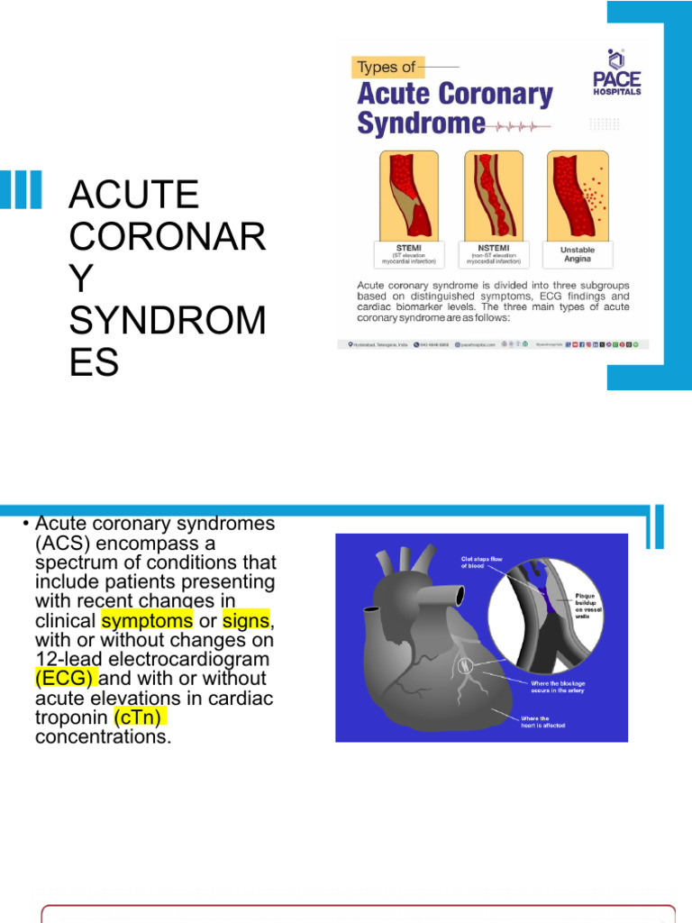 Acs | PDF