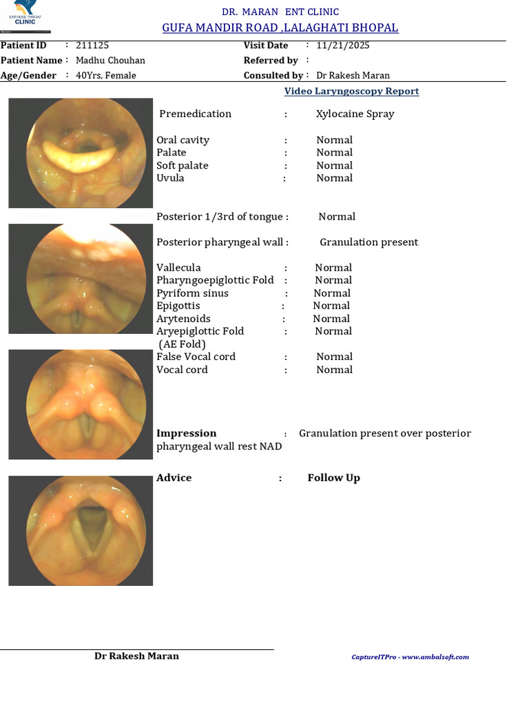 Video Laryngoscopy Report for Madhu Chouhan | PDF
