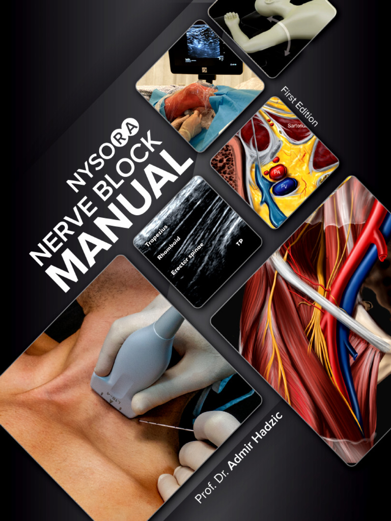 Hadzic's NYSORA Nerve Block Manual | PDF | Neck | Musculoskeletal System