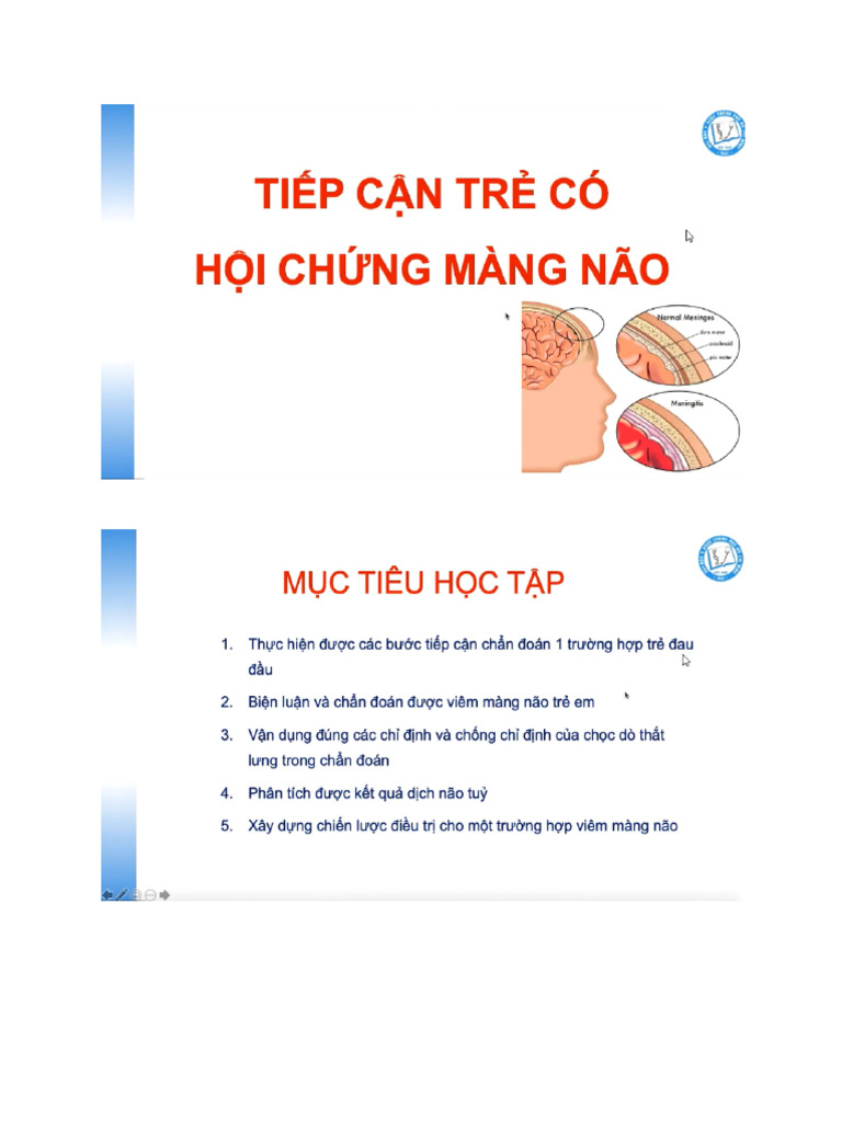 Cbl Viêm Màng Não | PDF