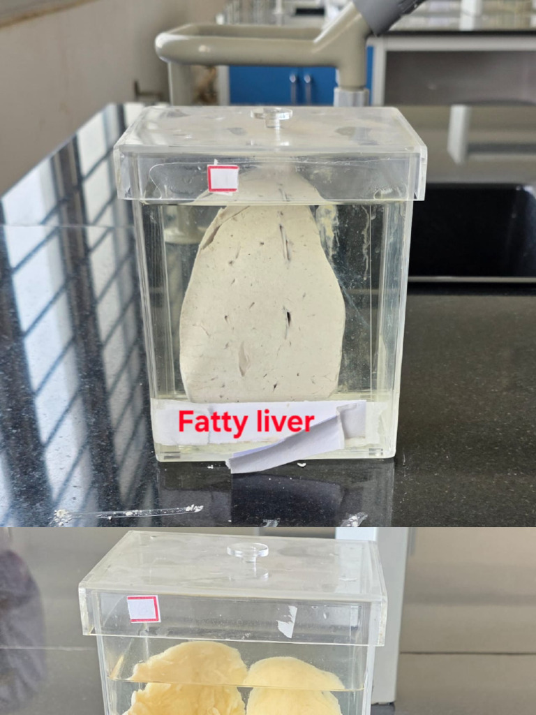 Pathology Gross Specimens | PDF