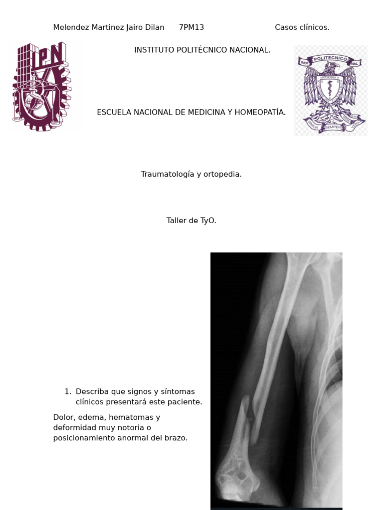 Casos clínicos Melendez Martinez Jairo Dilan | PDF | Hueso | Medicina