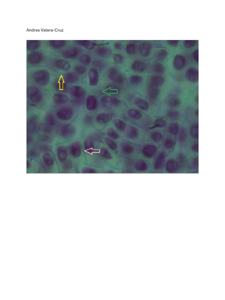 An Examination of the Relationship Between the Mitotic Stage and the ...