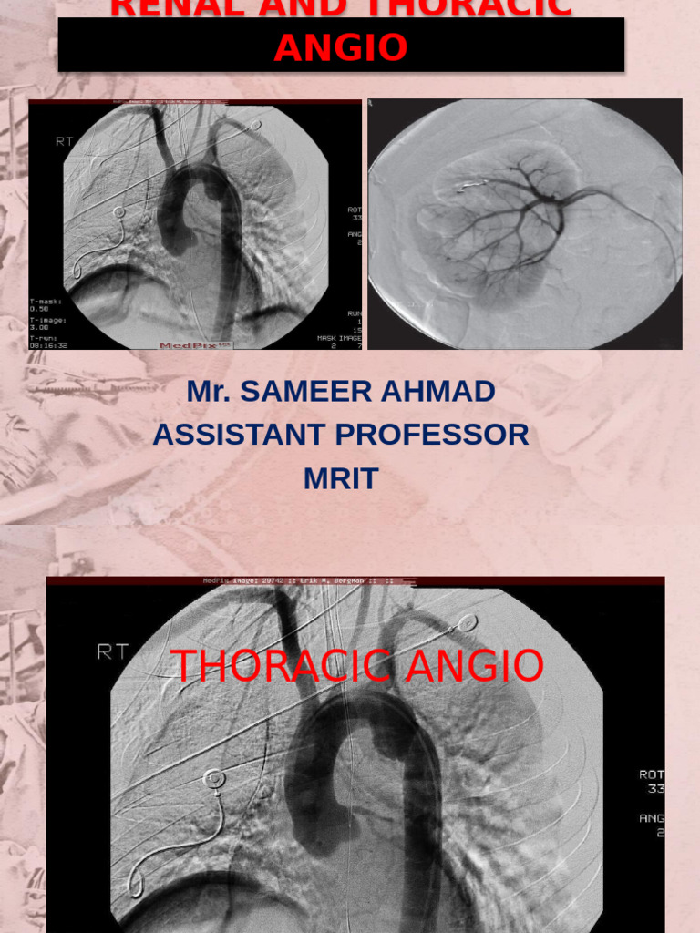 Renal and Thoracic Angiography Guide | PDF | Aorta | Angiography