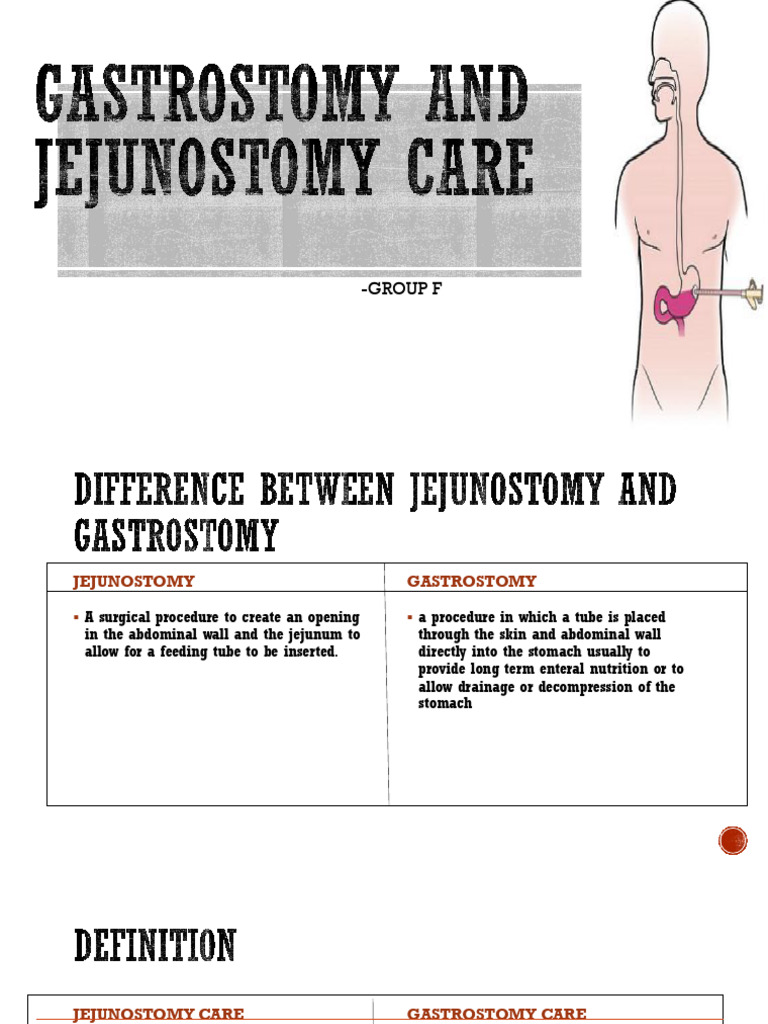 Jejunostomy vs. Gastrostomy Care Guide | PDF | Diseases And Disorders ...