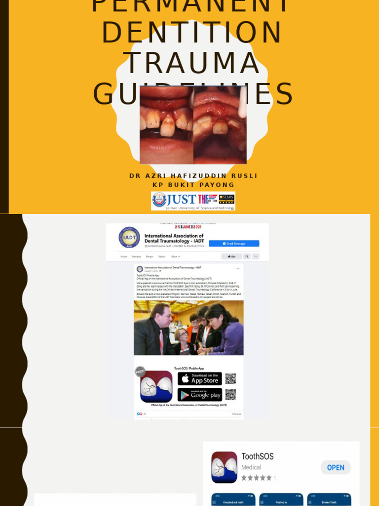 Dental Trauma Guidelines for Permanent Teeth | PDF | Medical ...
