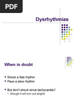 Atrial Fibrillation:Flutter in Pre-Excitation - LITFL - ECG Library ...