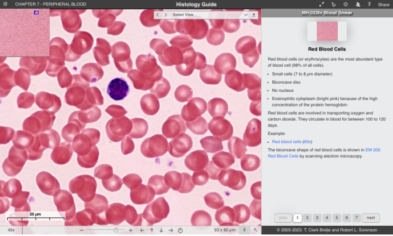 Blood Cells Peripheral Blood 7 | PDF | Red Blood Cell | Blood Cell