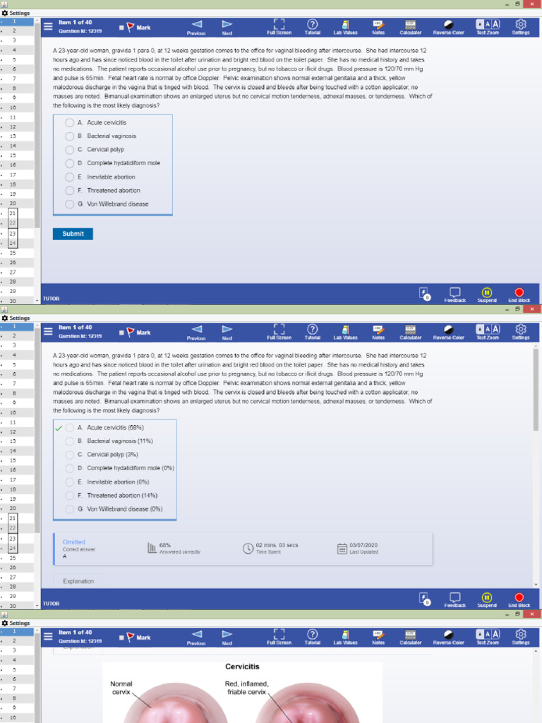 Obs & Gyn (Block 05+06) | PDF