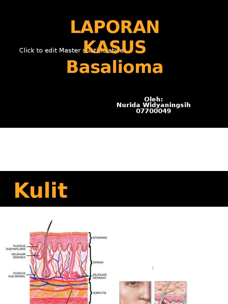 Basalioma | PDF