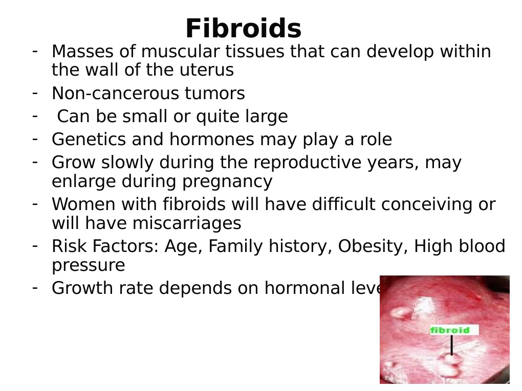 Uterine Fibroids | Download Free PDF | Uterus | Gynaecology