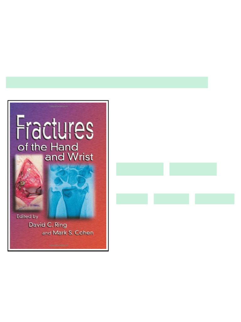 (Ebook) Fractures of the Hand and Wrist by David C. Ring, Mark Cohen ...
