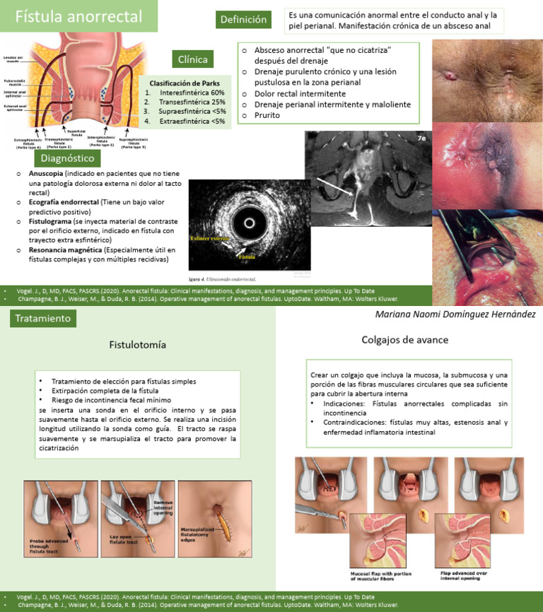 Flashcard 3. Fístula Anorrectal. MNDH | PDF | Recto | Gastroenterología