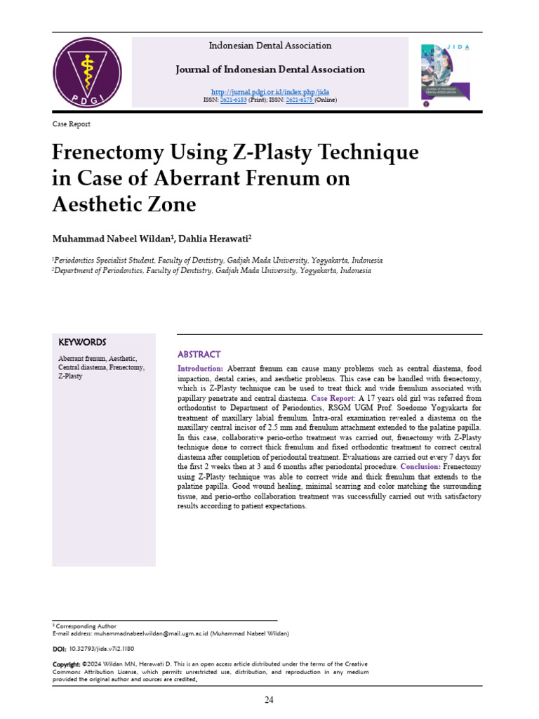 Frenectomy Using Z-Plasty Technique in Case of Aberrant Frenum on ...