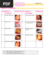 Códigos ICDAS en Odontología | PDF