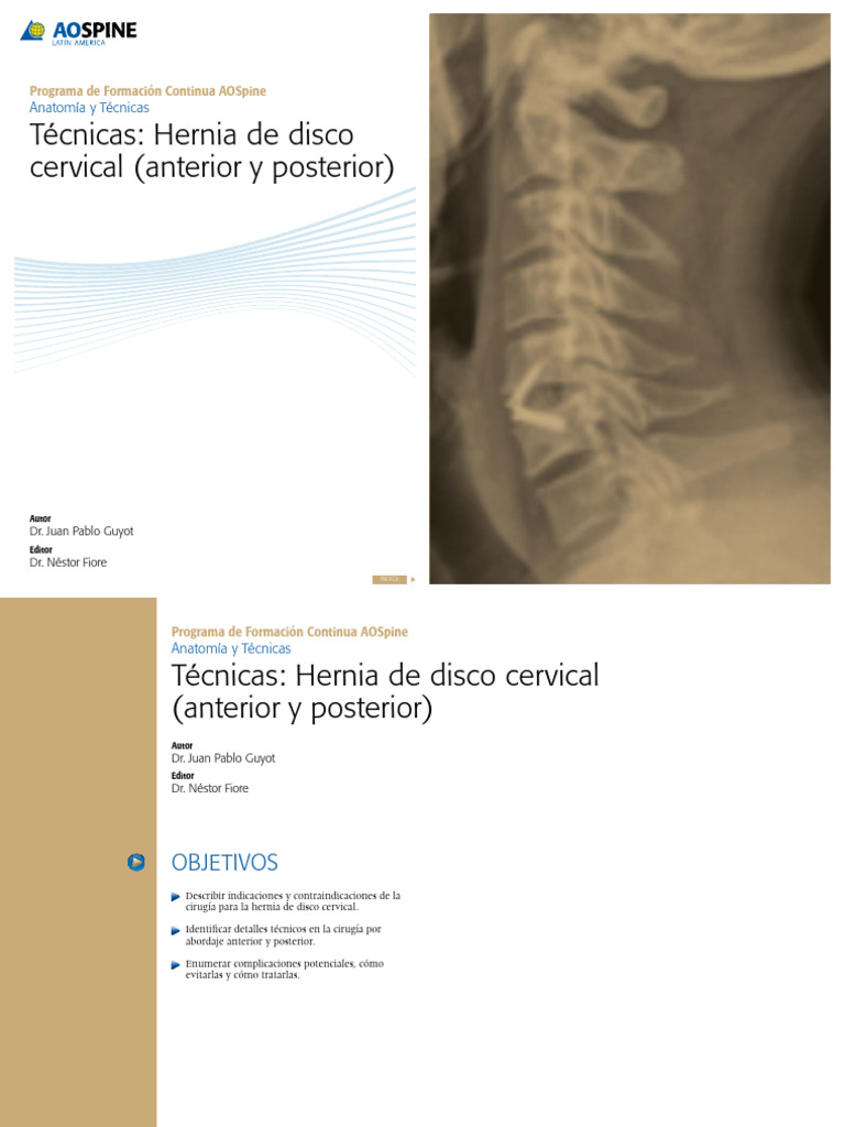 Aos_da_n1m1ts3_Guyot_esp - Final - Com Link | PDF | Cirugía | Anatomía humana