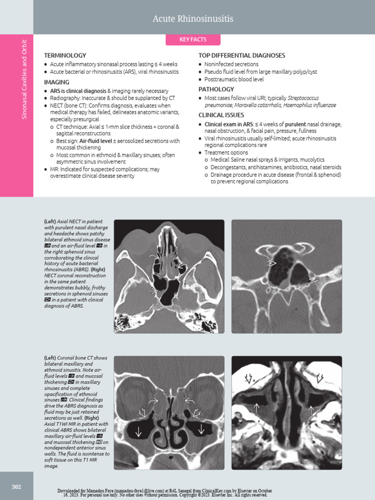 Acute Rhinosinusitis Overview and Imaging | PDF | Clinical Medicine ...