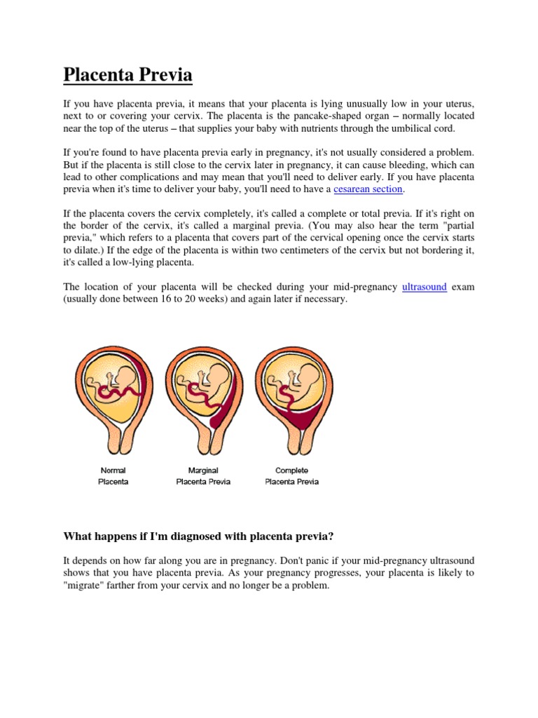 Placenta Previa | PDF | Pregnancy | Caesarean Section