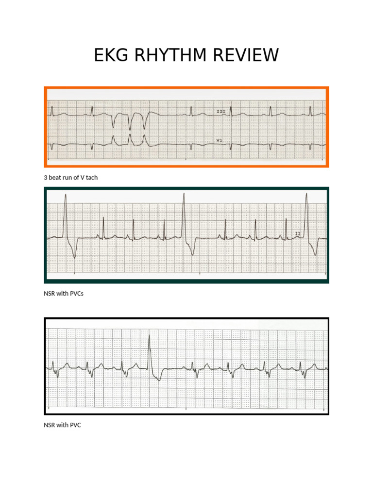 EKG strips Answer Key(1) | PDF