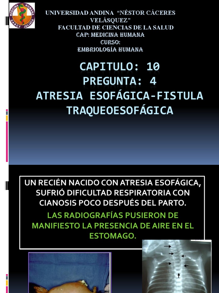 ATRESIA ESOFÁGICA-fistula Traqueoesofágica | PDF | Pulmón | Anatomía