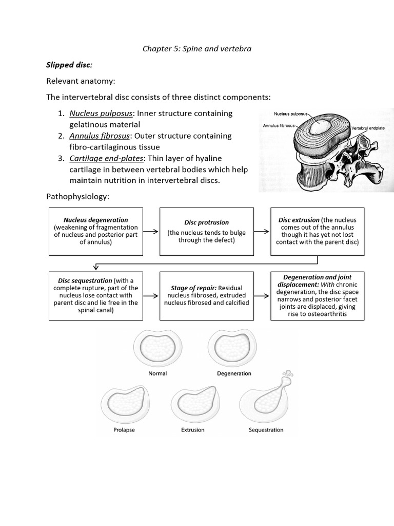 Slipped Disc and Spondylolisthesis Overview | PDF | Vertebra | Back Pain