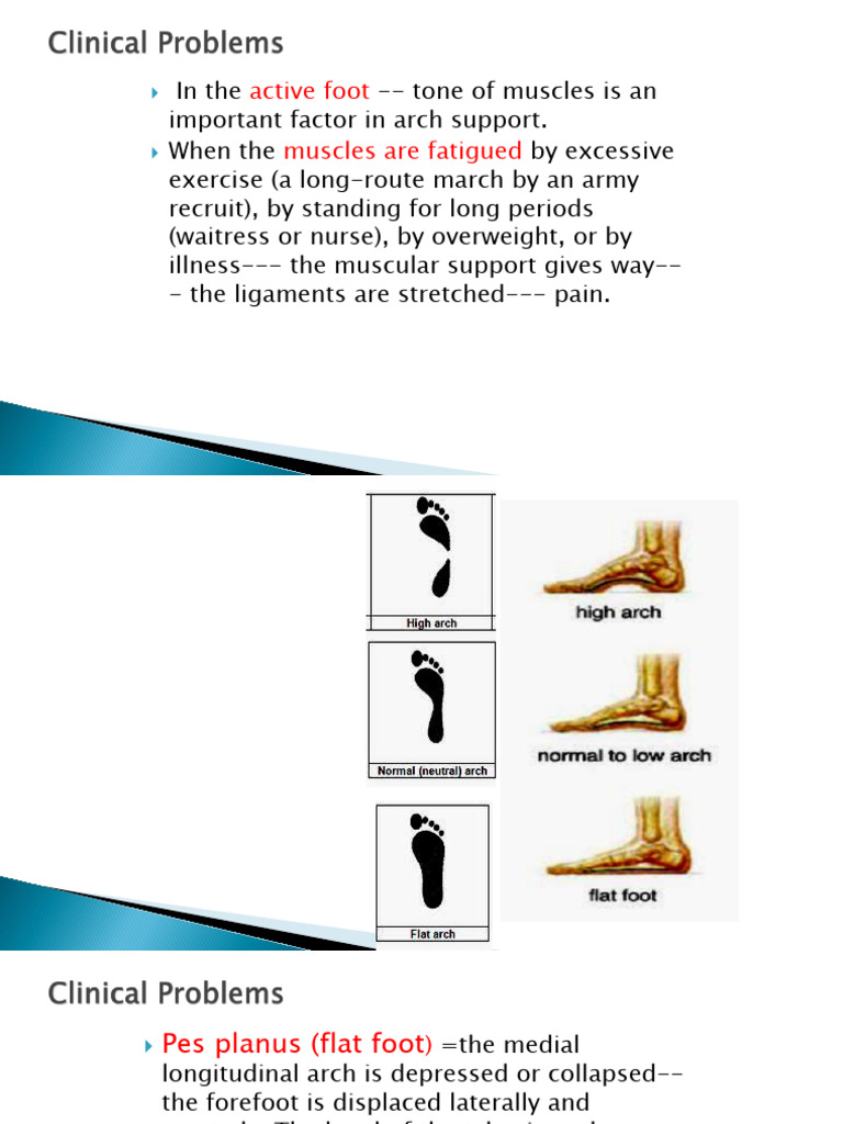 ClinicalAnatomy -Arches of Foot | PDF | Foot | Musculoskeletal System