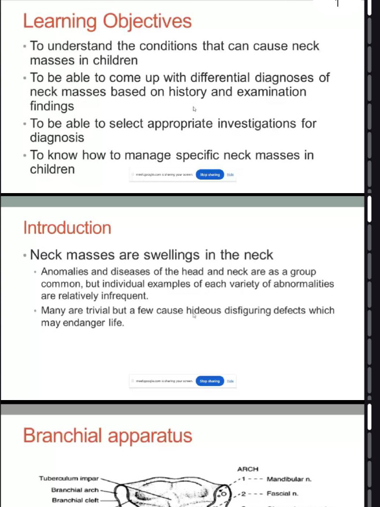 Neck Swelling in children | PDF