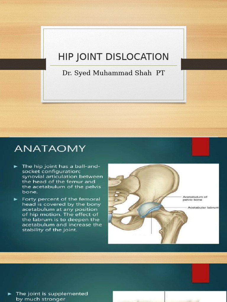 Hip Dislocation | PDF