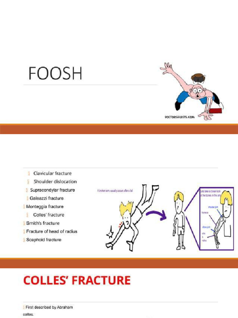 Foosh | PDF