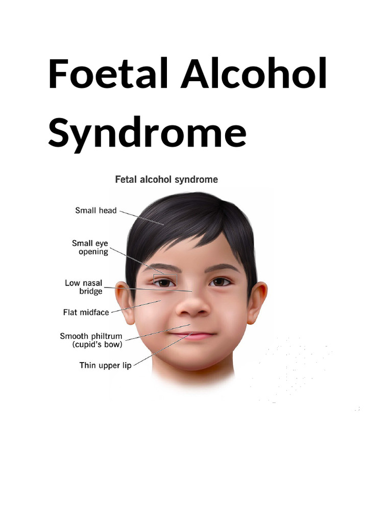 Foetal Alcohol Syndrome Booklet | PDF | Attention Deficit Hyperactivity ...